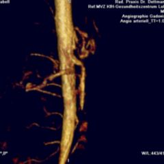 Truncus coeliacus - DocCheck Flexikon