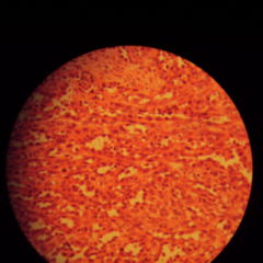 Sarkomer - DocCheck Flexikon