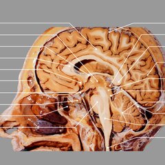 Flexikon: Schnittbildpräparat - DocCheck Flexikon