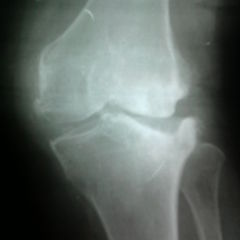 Kompartiment - DocCheck Flexikon