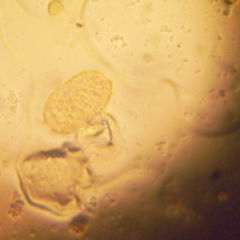 Paradoxe Diarrhö - DocCheck Flexikon