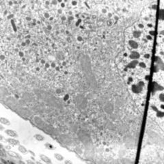 Endosom - DocCheck Flexikon