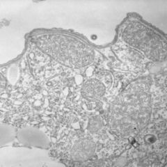 Crossing-over - DocCheck Flexikon