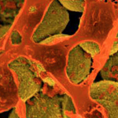 Antibiogramm - DocCheck Flexikon