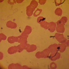 Borrelia duttoni - DocCheck Flexikon