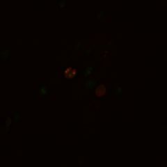 Punctum maximum - DocCheck Flexikon