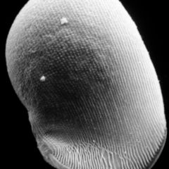 Herniation Pit - DocCheck Flexikon
