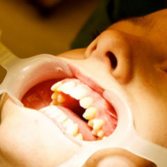 Endokarditis - DocCheck Flexikon