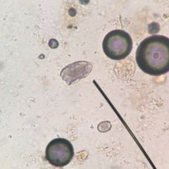 Helminthen - DocCheck Flexikon