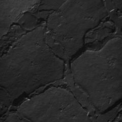 Sequester - DocCheck Flexikon