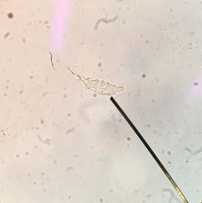 Demodex spp. - DocCheck