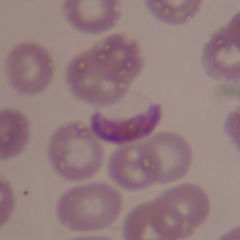 Ligamentum falciforme - DocCheck Flexikon