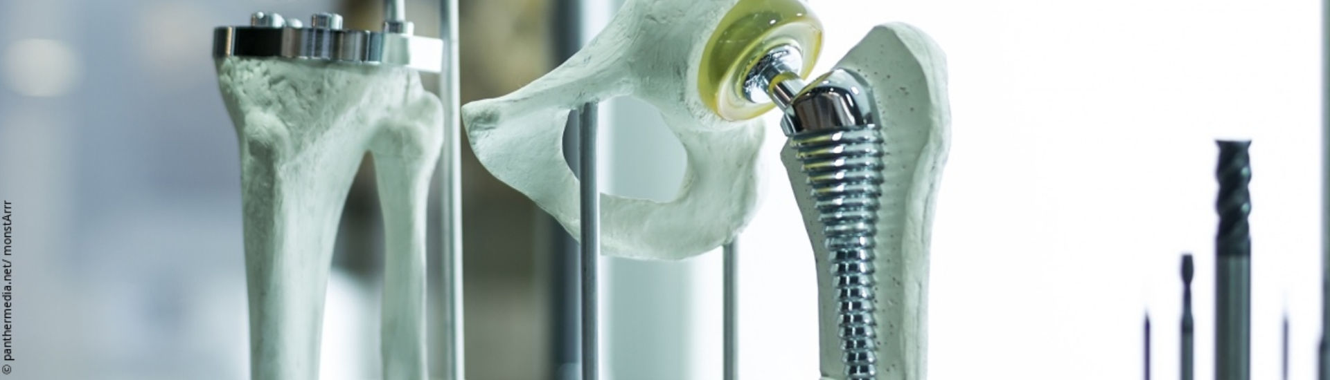 Orthopedic implant: More comfortable thanks to full weight-bearing ...