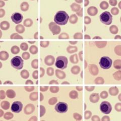 Normoblast - DocCheck Flexikon