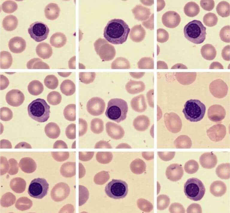 Nucleated red blood cell (Normoblast) - DocCheck