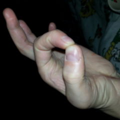 Faszie - DocCheck Flexikon