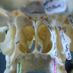 Choane - DocCheck Flexikon