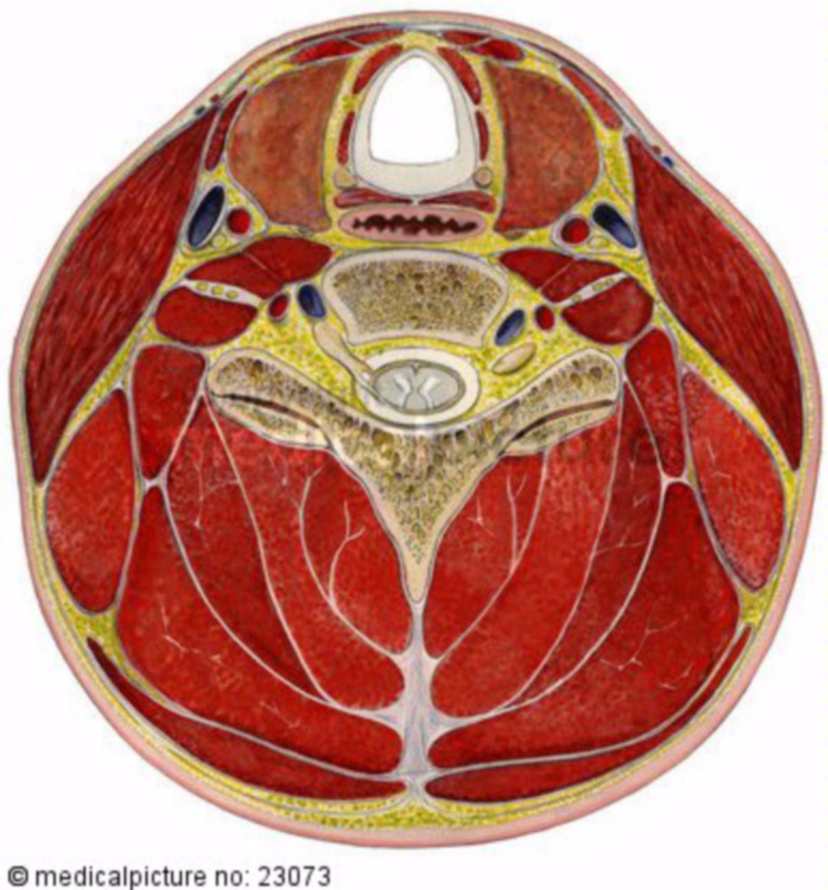 HWS-Syndrom - DocCheck Flexikon