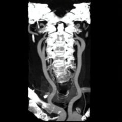 Lauenstein-Aufnahme - DocCheck Flexikon
