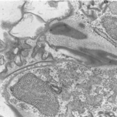 Polysom - DocCheck Flexikon