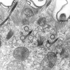 Zellfusion - DocCheck Flexikon