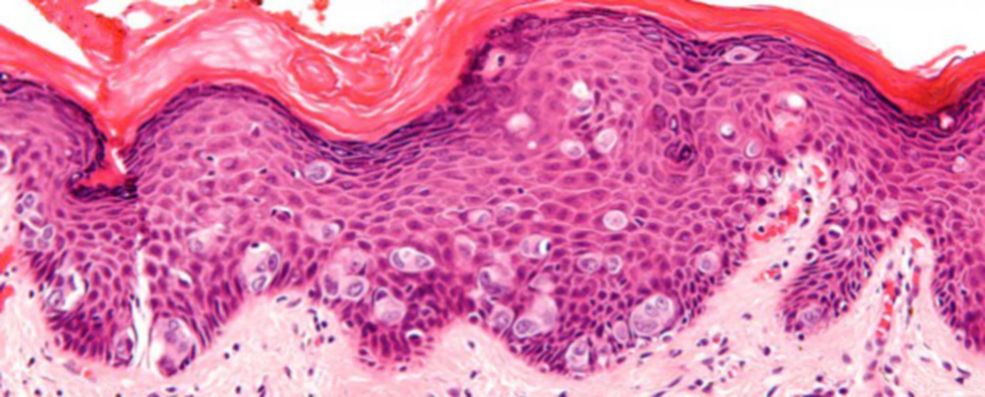 Cellule Di Merkel Istologia Fondamenti Di Biologia / Citologia E
