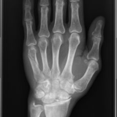 Handwurzelknochen - DocCheck Flexikon