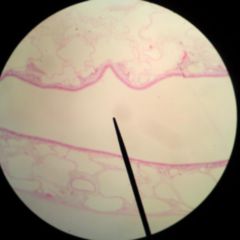 Flimmerepithel - DocCheck Flexikon
