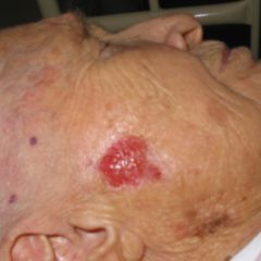 Basalzelle - DocCheck Flexikon