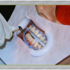 Absaugen - DocCheck Flexikon