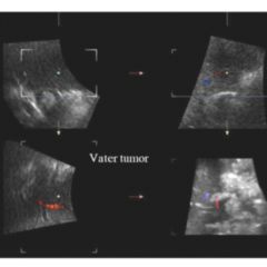 Vater-Pacini-Körperchen - DocCheck Flexikon