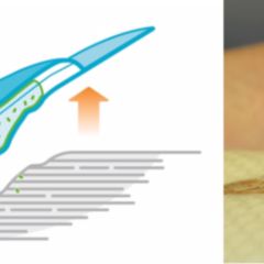 Mazeration - DocCheck Flexikon