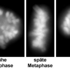 Mitose - DocCheck Flexikon
