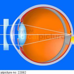 Konkav - DocCheck Flexikon