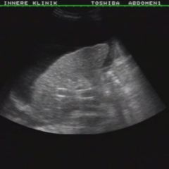 Hypophysäres Pfortadersystem - DocCheck Flexikon