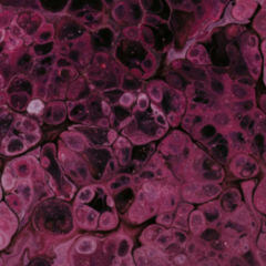 Gewebeprobe - DocCheck Flexikon