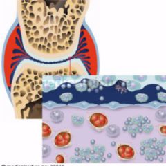 Synovialis - DocCheck Flexikon