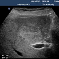 Lacuna musculorum - DocCheck Flexikon