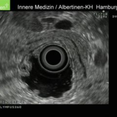 Ductus parotideus - DocCheck Flexikon