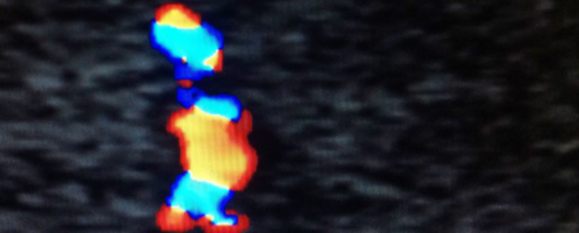 Frühzeitiges Einüben der Work-Life-Balance - DocCheck