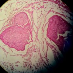 Perineurium - DocCheck Flexikon