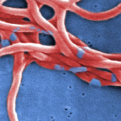 Borrelia afzelii - DocCheck Flexikon