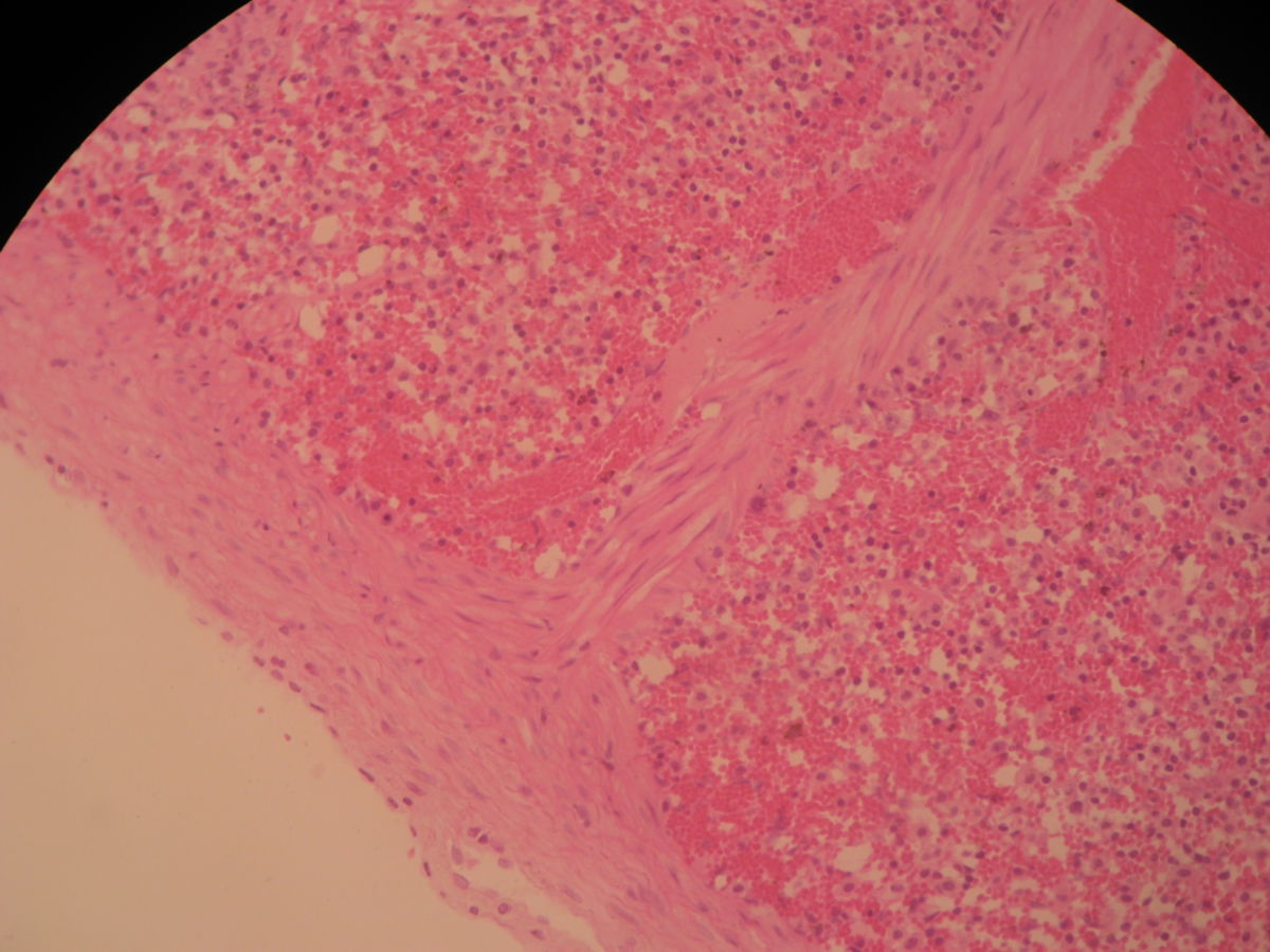 Spleen of pig, trabecula and capsule out of connective tissue - DocCheck