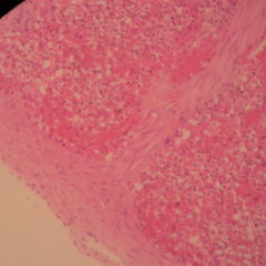 Trabekel - DocCheck Flexikon