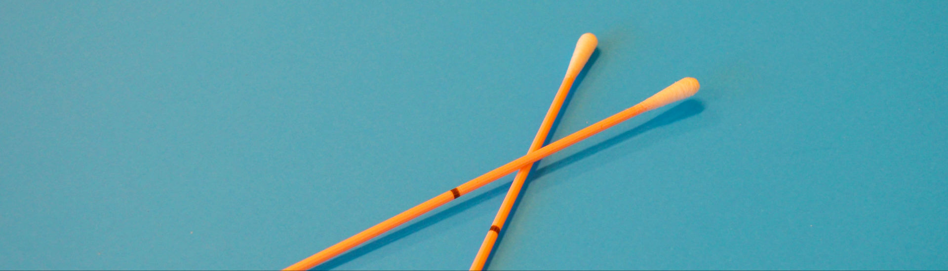 Abstrich vs. Urinprobe: Was ist zuverlässiger? - DocCheck