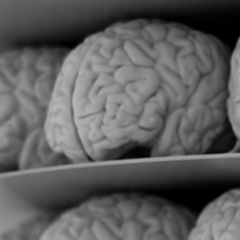 Temozolomid - DocCheck Flexikon