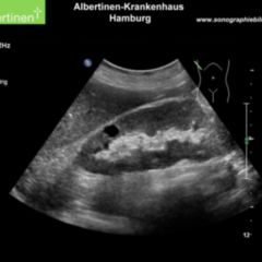 Kleine Furche - DocCheck Flexikon