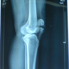 Sesambein - DocCheck Flexikon