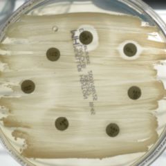 Antibiogramm - DocCheck Flexikon