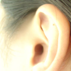 Reinke-Kristall - DocCheck Flexikon